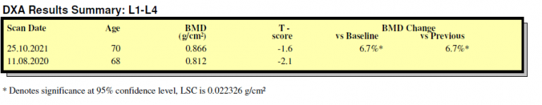 Densytometria | Badanie densytometryczne - Gyncentrum
